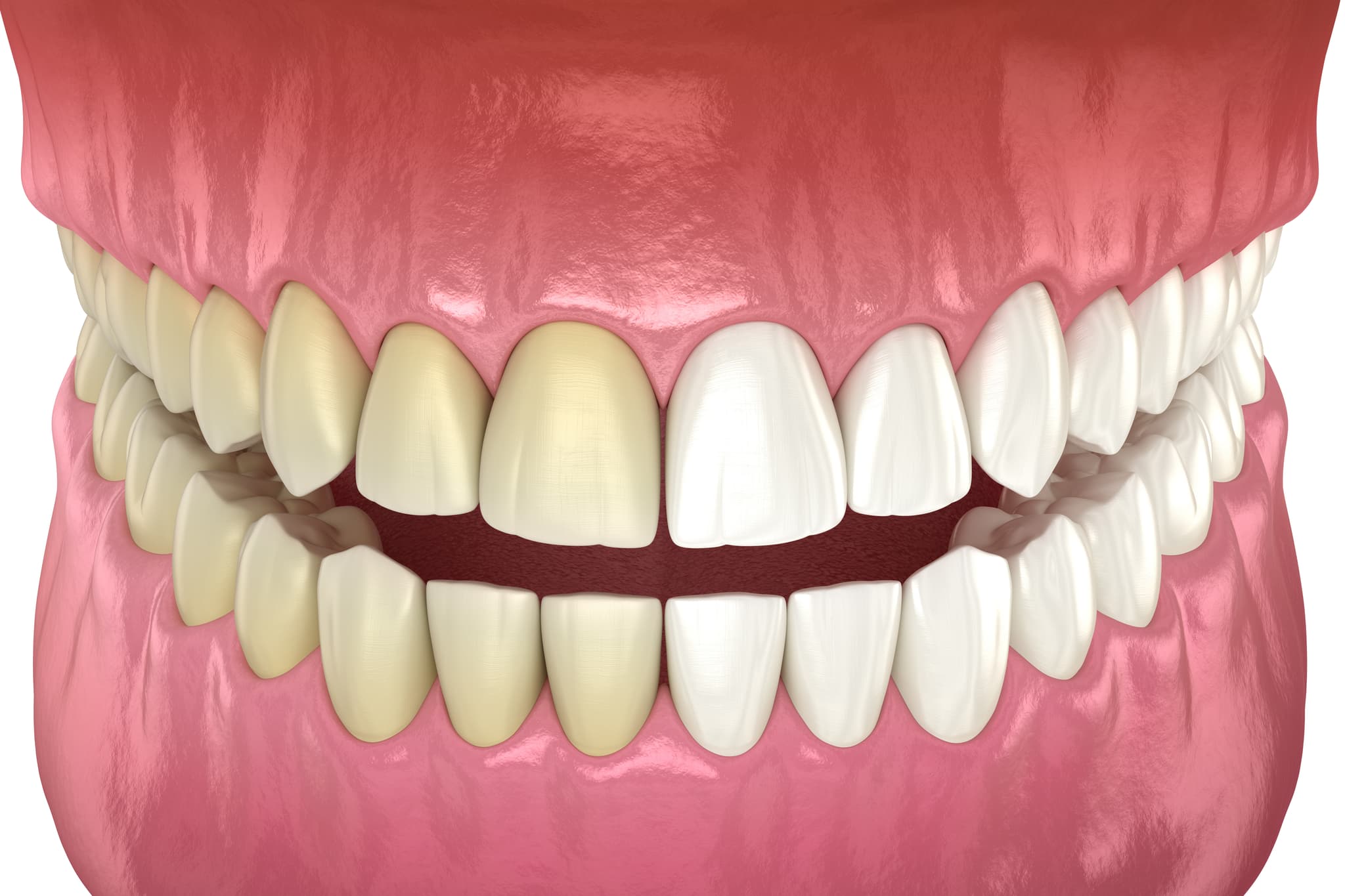 Private Dentist in Bridgwater, Somerset | Supernova Dental